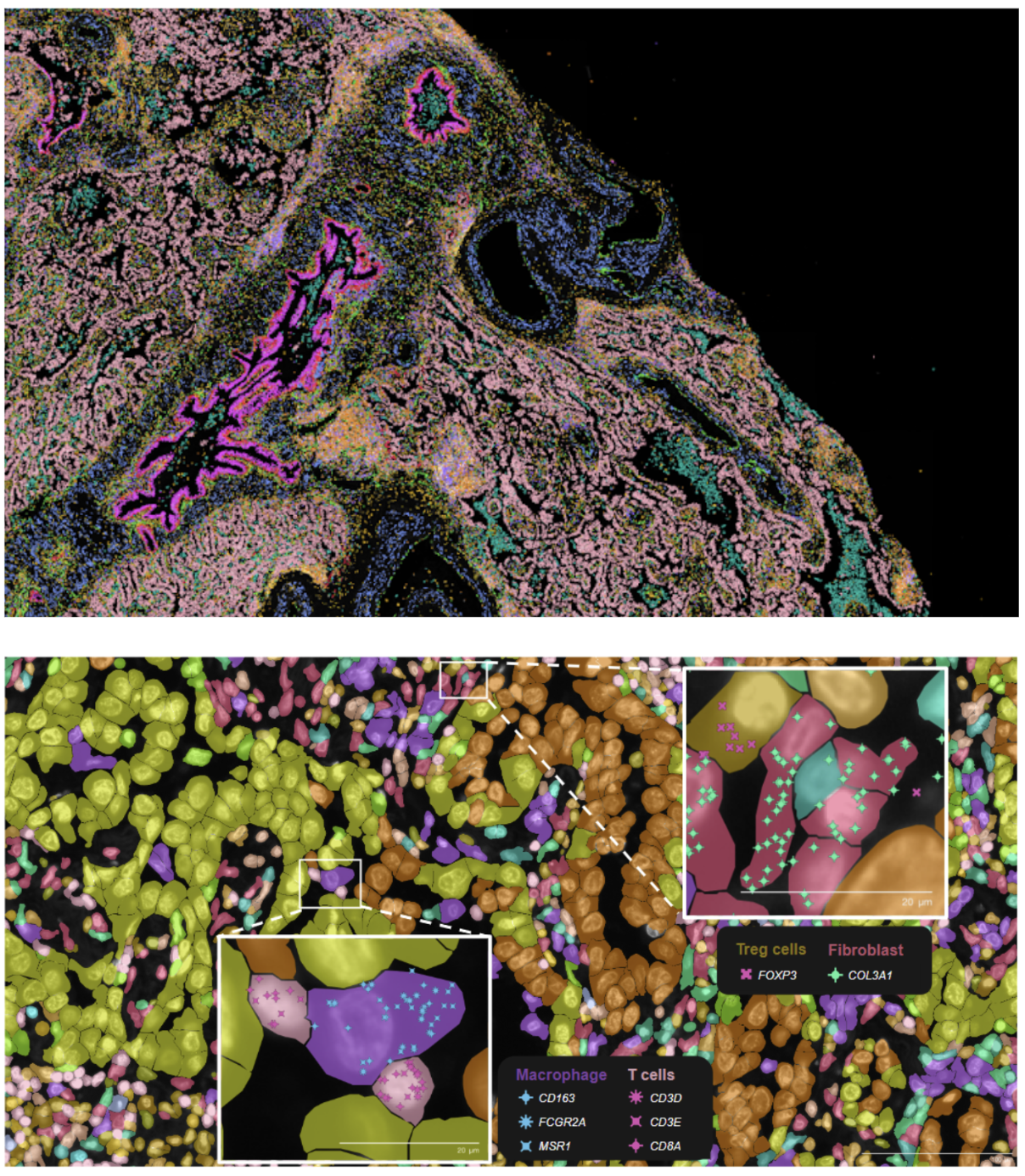 Optimizing your spatial transcriptomics research with Visium HD and Xenium Prime 5K - 10x Genomics